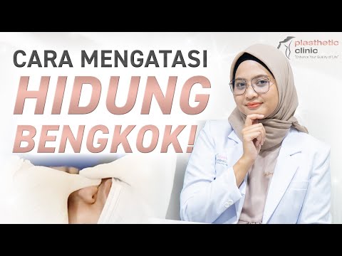 CARA MENGATASI HIDUNG BENGKOK | BISA DENGAN RHINOPLASTY ?!