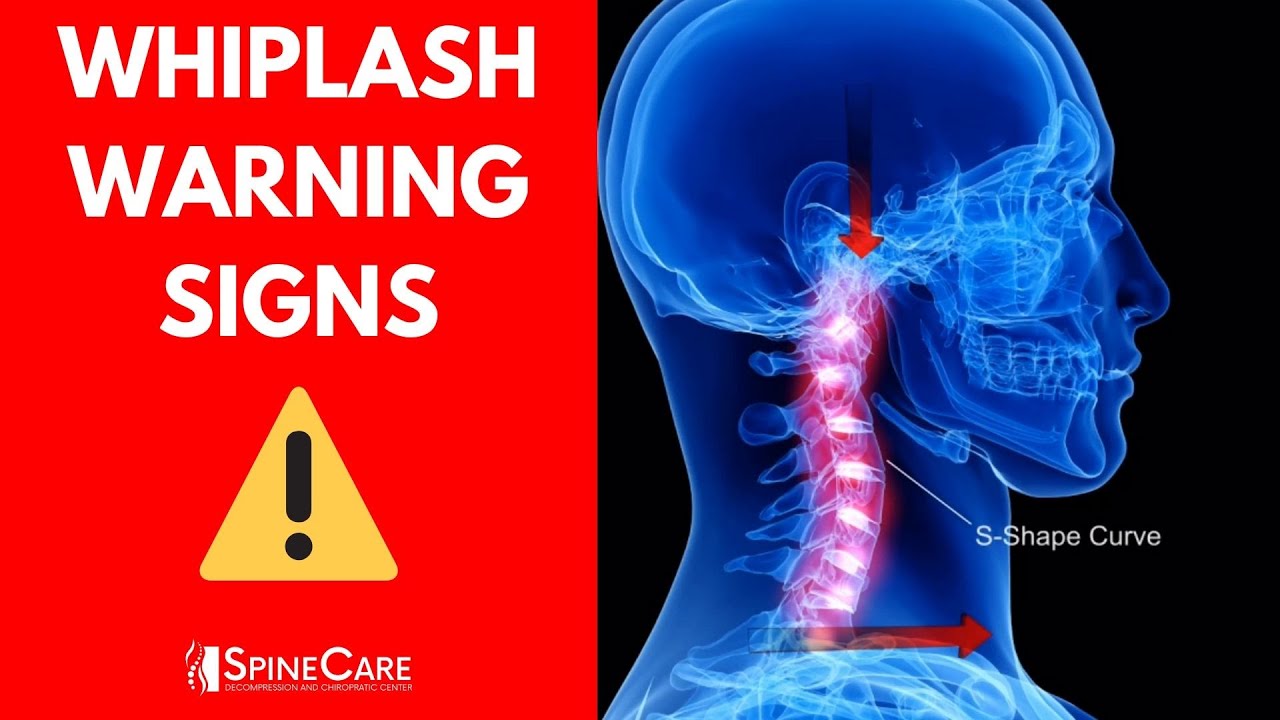 5 WARNING Signs of a Whiplash Injury | Discussed by St. Joseph MI ...