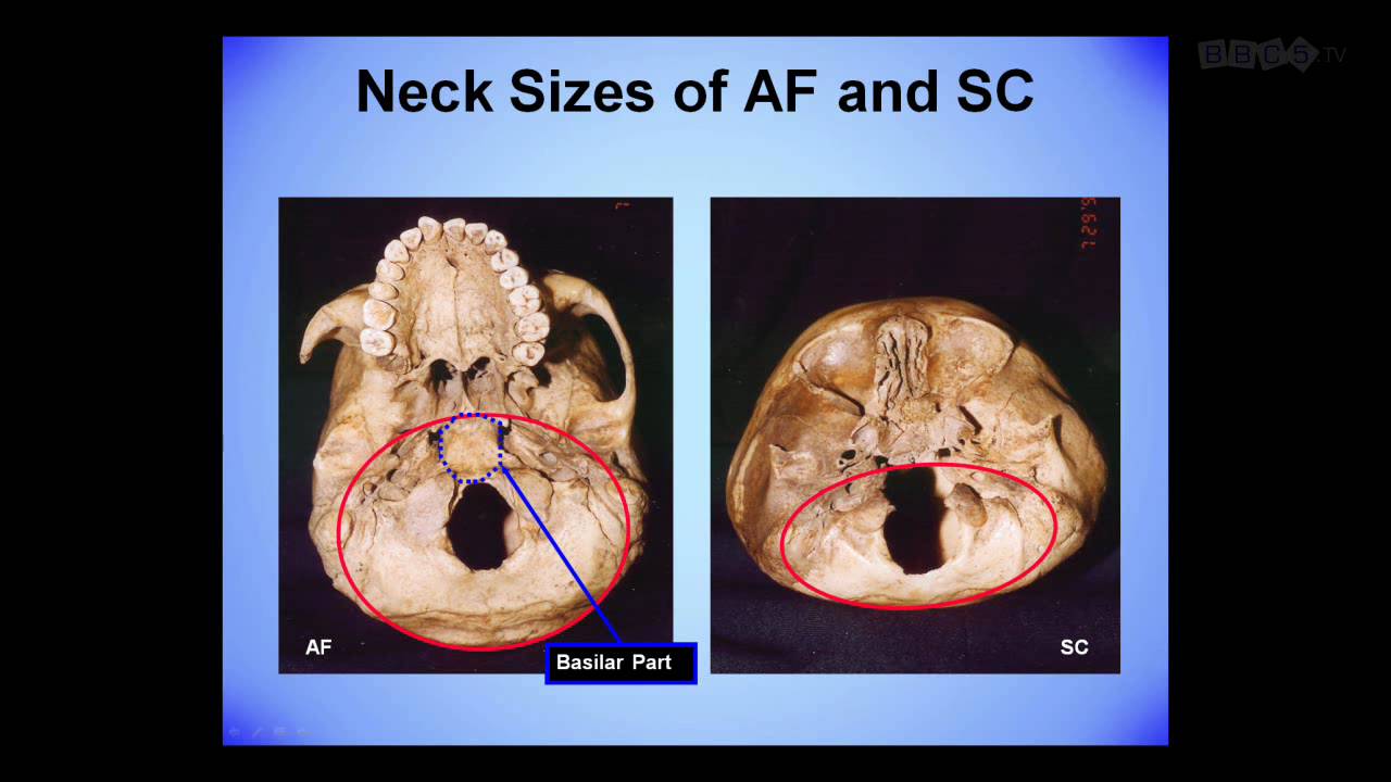 Lloyd Pye - The Starchild Skull Enigma Part 3/8 - YouTube