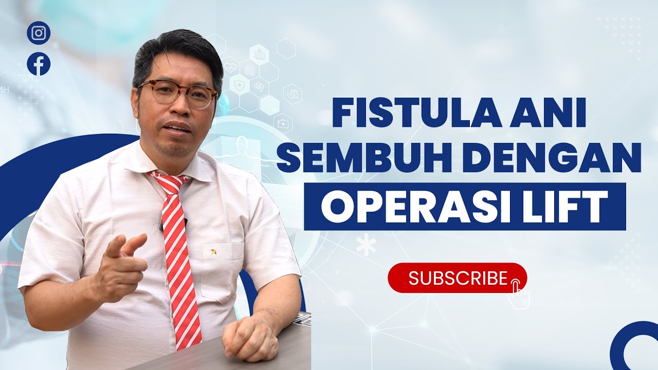 FISTULA ANI SEMBUH DENGAN OPERASI LIFT (Ligation of the ...