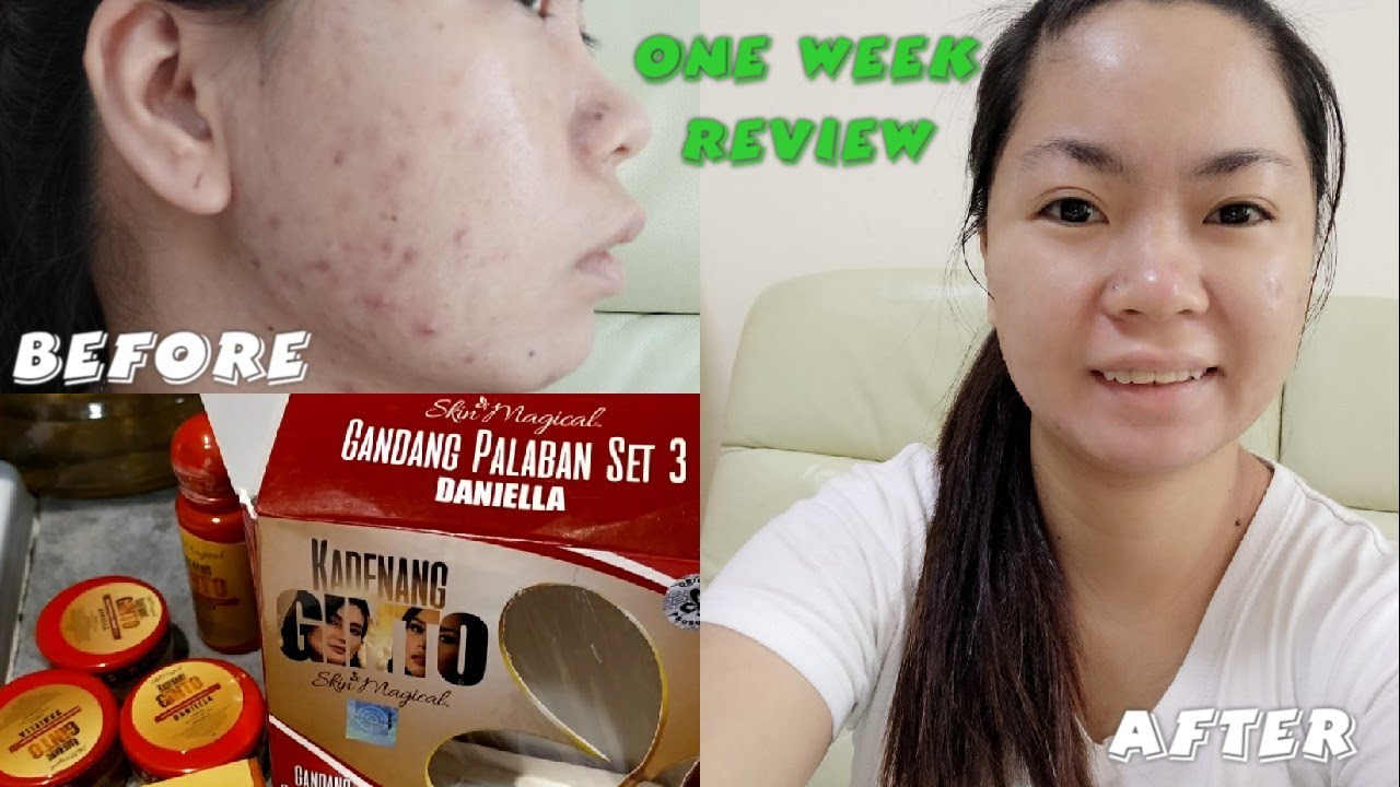 SKIN MAGICAL REJUVENATING SET 3 | 1 Week Review #skinmagical # ...