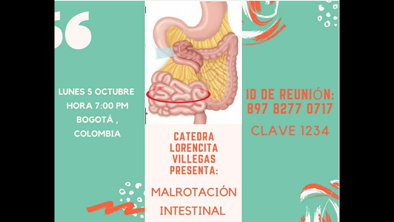 Malrotación intestinal - YouTube