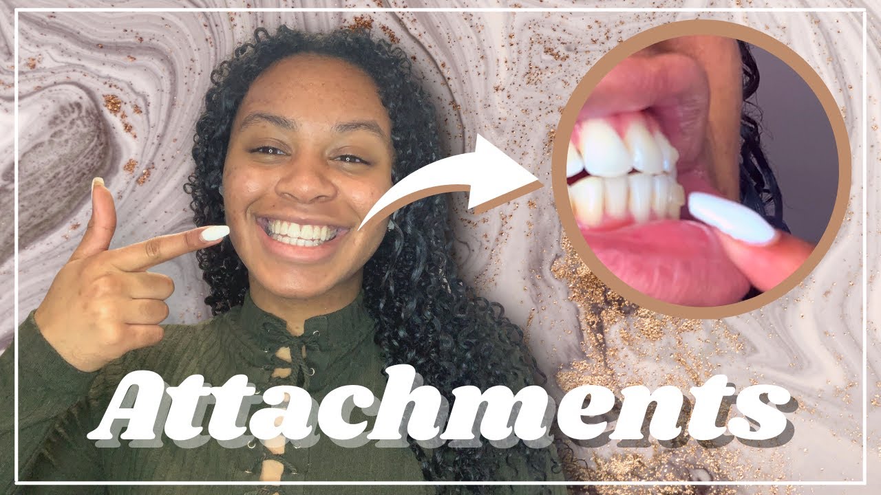Invisalign Attachments 101 - YouTube