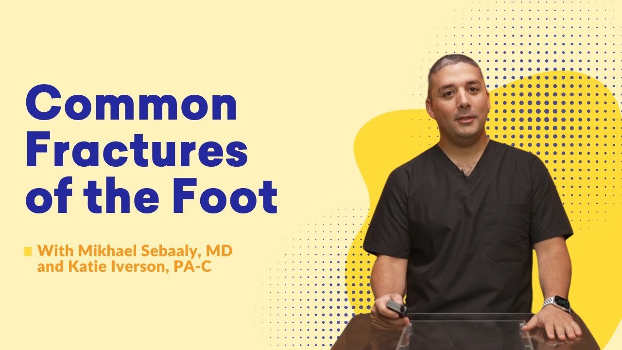 Common Fractures of the Foot - Radiology Bootcamp: Plain Films - YouTube