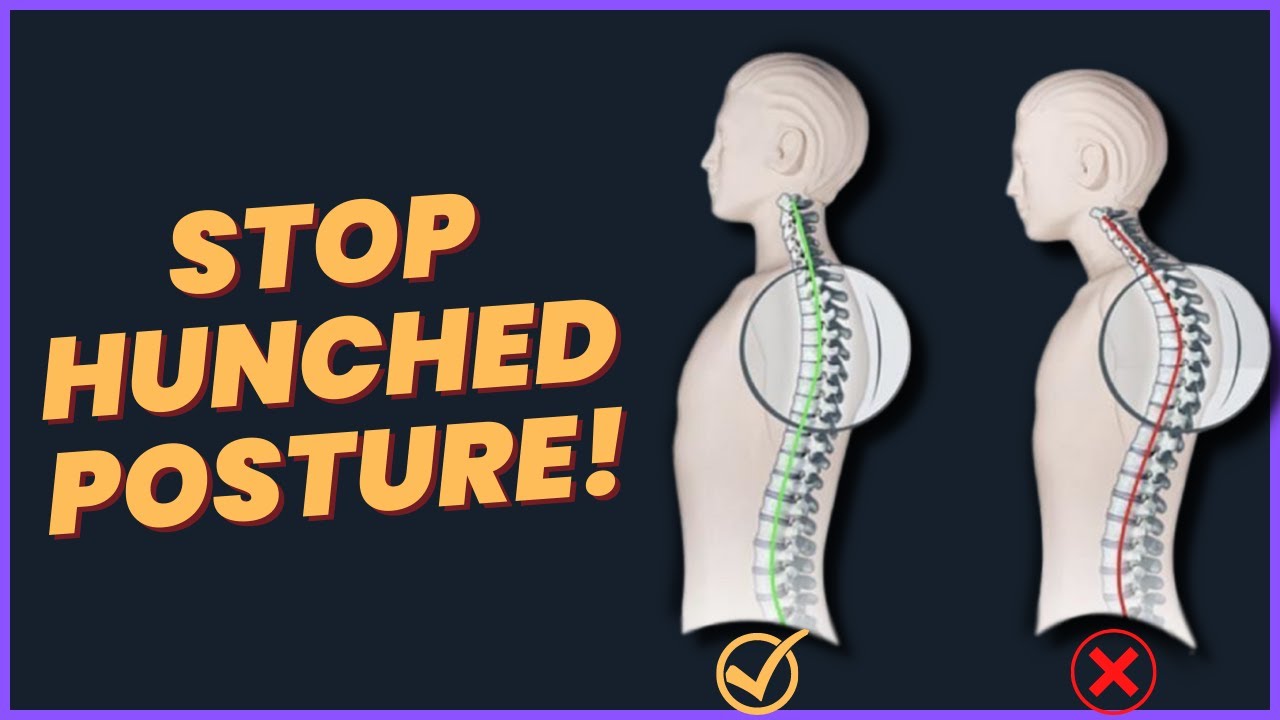 Fix Your Posture with 5 Easy Exercises! How to Correct Humpback Posture ...