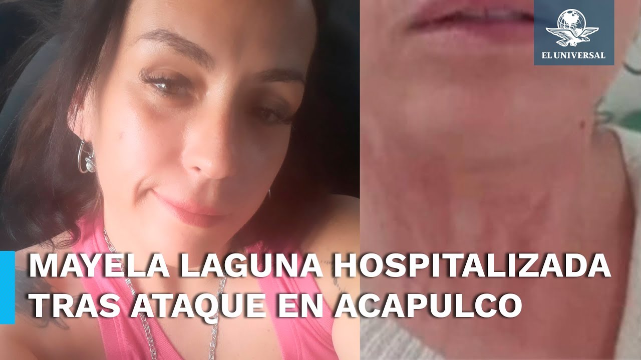 Mayela Laguna sufre brutal ataque en Acapulco - YouTube