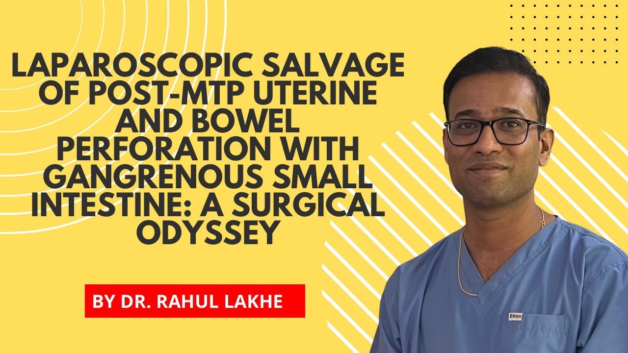 LAPAROSCOPIC SALVAGE OF POST-MTP BOWEL PERFORATION : A SURGICAL ODYSSEY ...
