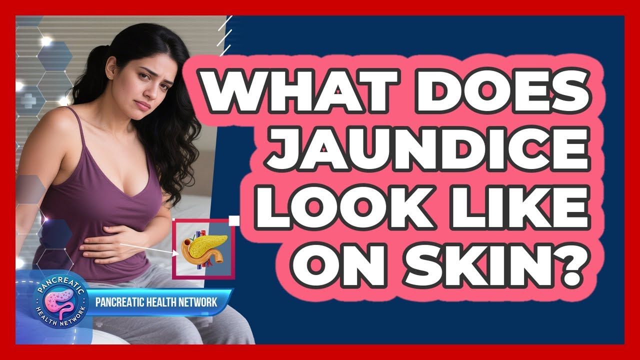 What Does Jaundice Look Like on Skin? - YouTube