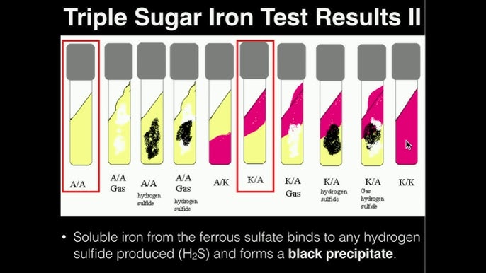 Triple Sugar Iron (TSI) Agar, 49% OFF Triple Sugar Iron (TSI) Agar, 49% OFF