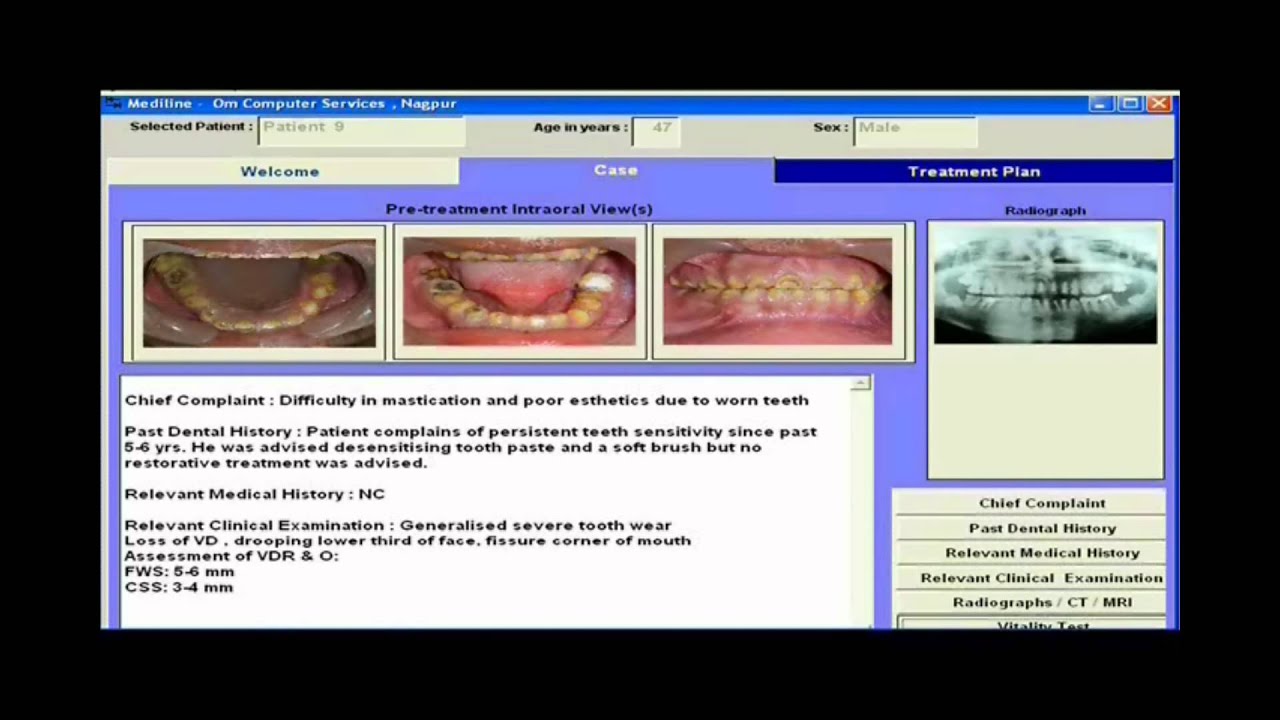 Impact of computer-based treatment planning software -- Video abstract ...