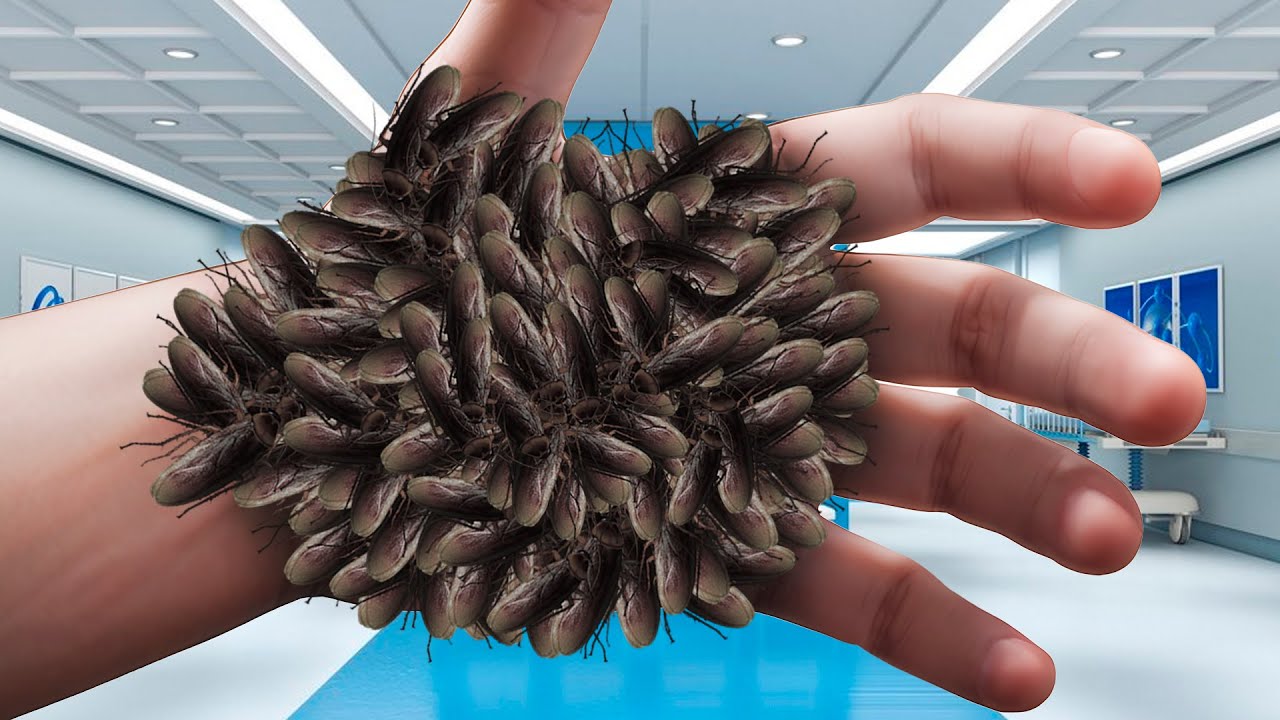 ASMR Hand Treatment Animation Remove Maggots & Ticks Infection | ASMR ...