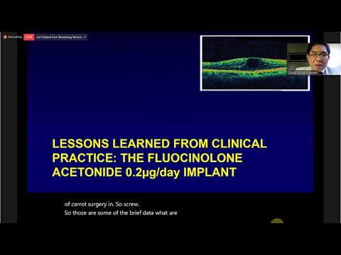 when treat the patient with retisert. NDQ - YouTube