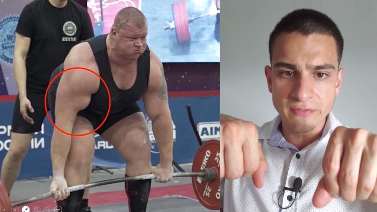 Lesão do Bíceps Braquial no Deadlift | Daniel Bohn - YouTube