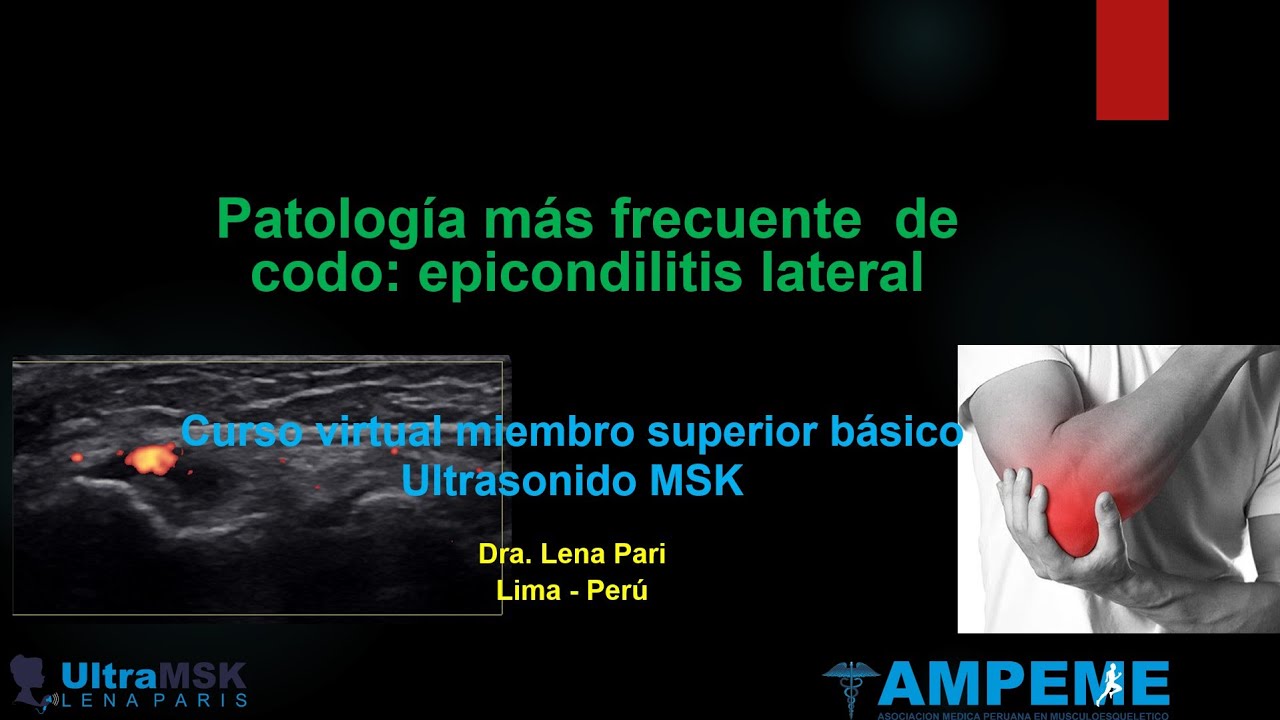 Epicondilitis lateral, como hago el diagnostico con ultrasonido ? - YouTube