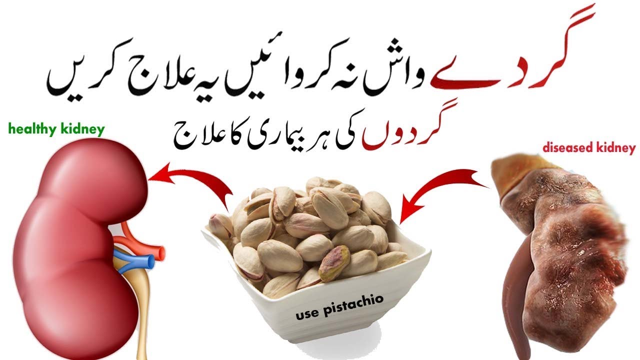 Treatment of All Kidney Diseases | Gurdon ki har bimari ilaj | Kidney ...
