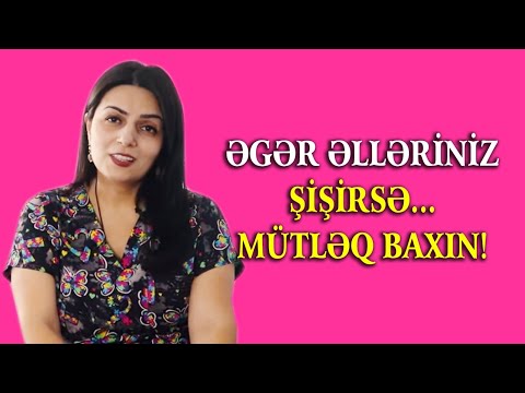 Qolunuz Şişirsə MÜTLƏQ İzləyin! - Düyünlər Belə Çıxarılır