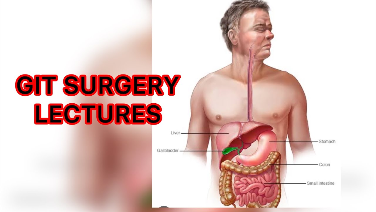 GIT SURGERY LECTURES part 3, GERD / ESOPHAGUS - YouTube