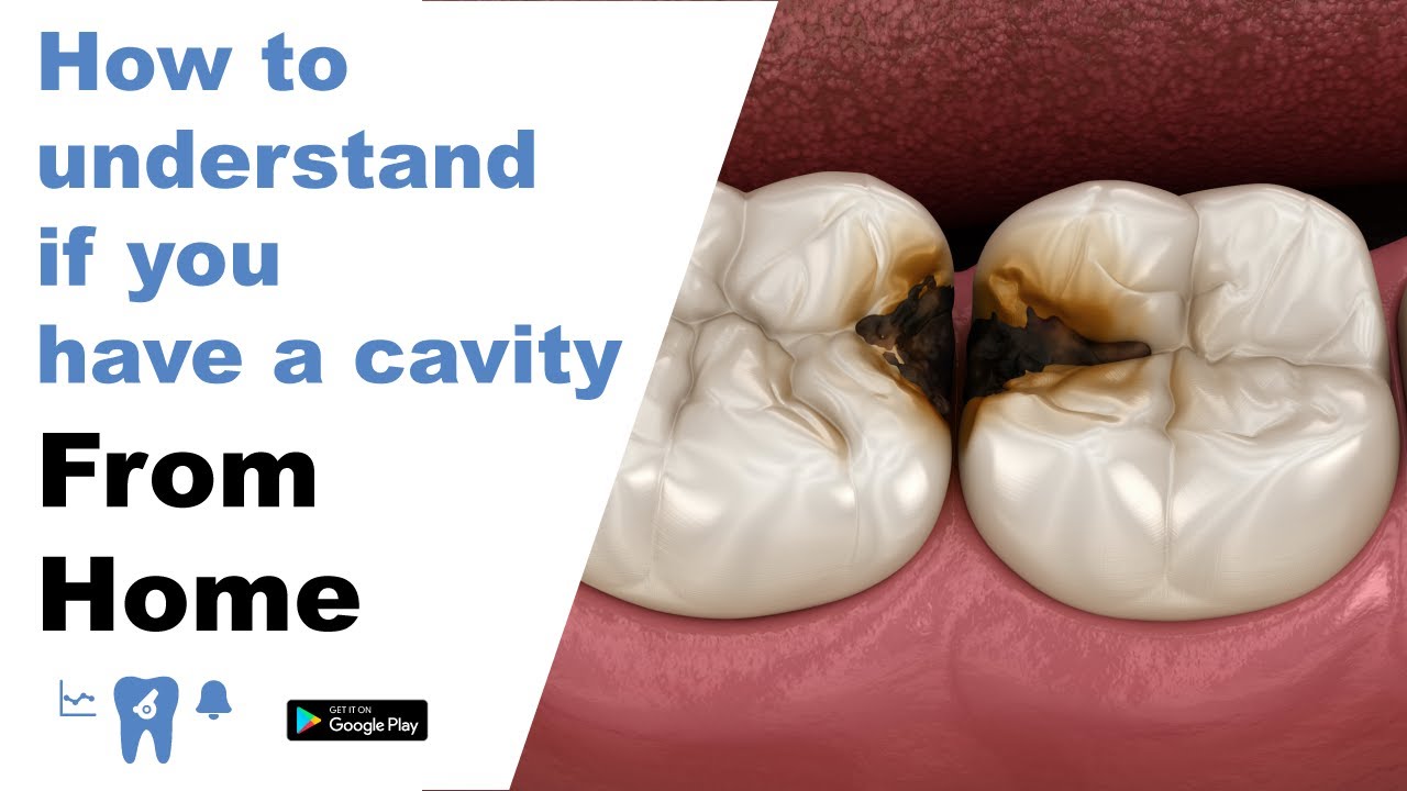 How to understand if you have a cavity from home. - YouTube