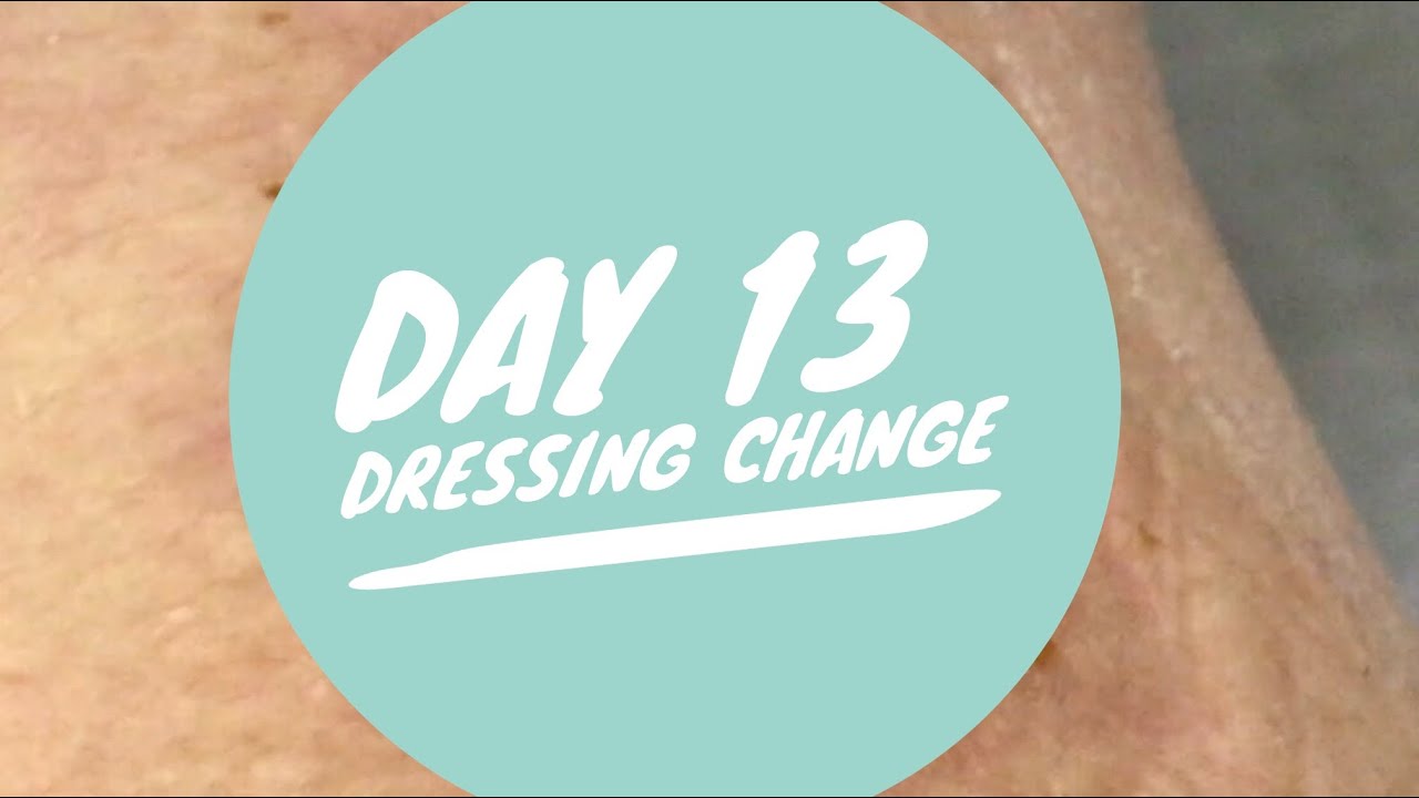Abscess Dressing Change - Day 13 - YouTube