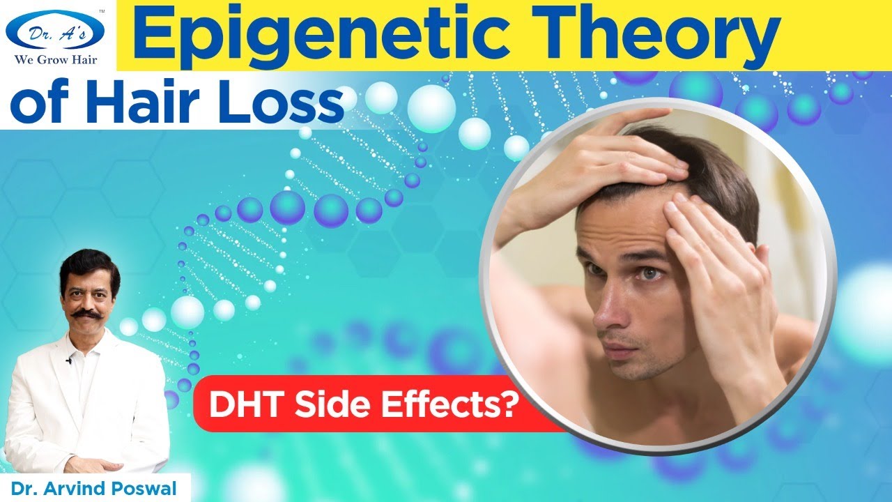 गंजापन किस वजह से होता है? | Epigenetic Theory of Hair Loss | DHT Side ...