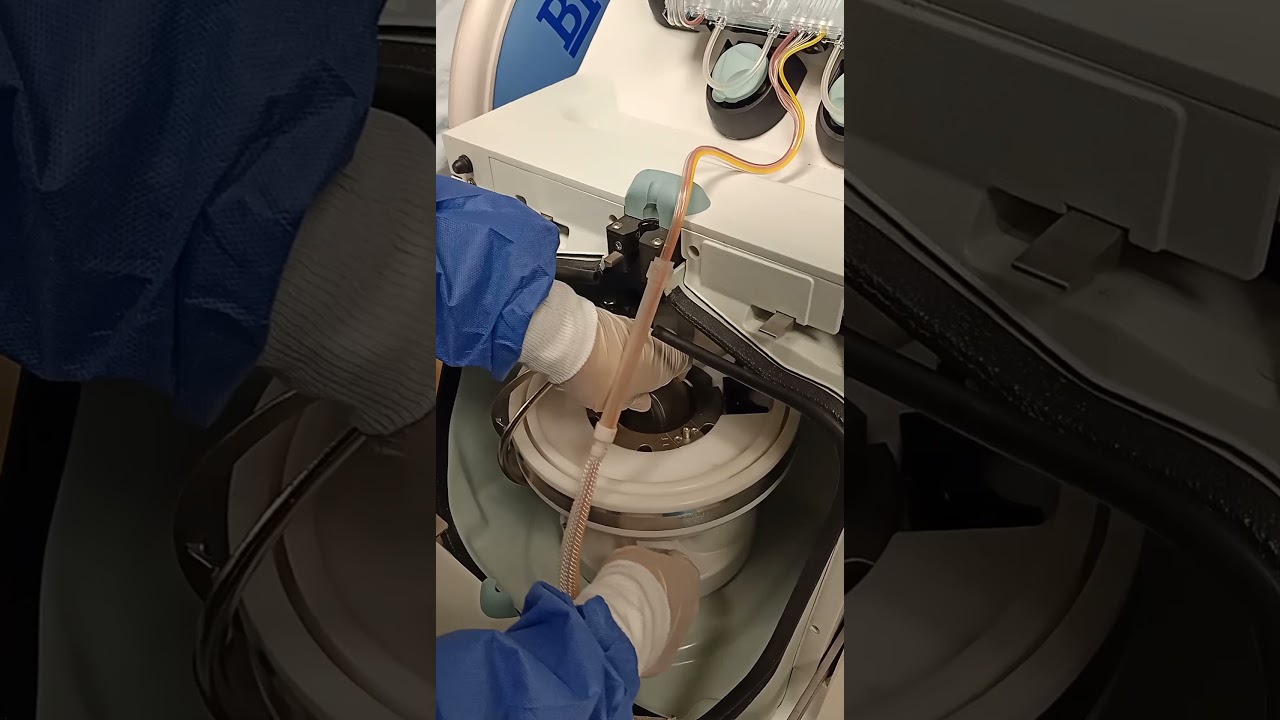 preparation to Apheresis platelets collected on Trima Accel - YouTube