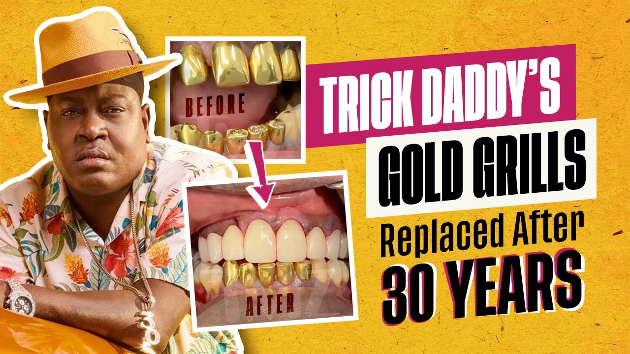 Celebrity Smile News: Rapper Trick Daddy Replaces Gold Teeth With ...