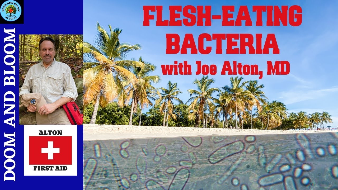 FLESH-EATING BACTERIA, by Doctor Joseph Alton MD - YouTube