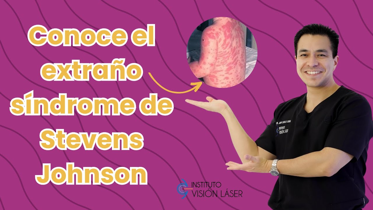 Síndrome de Stevens Johnson ¿conoces esta rara enfermedad? - YouTube