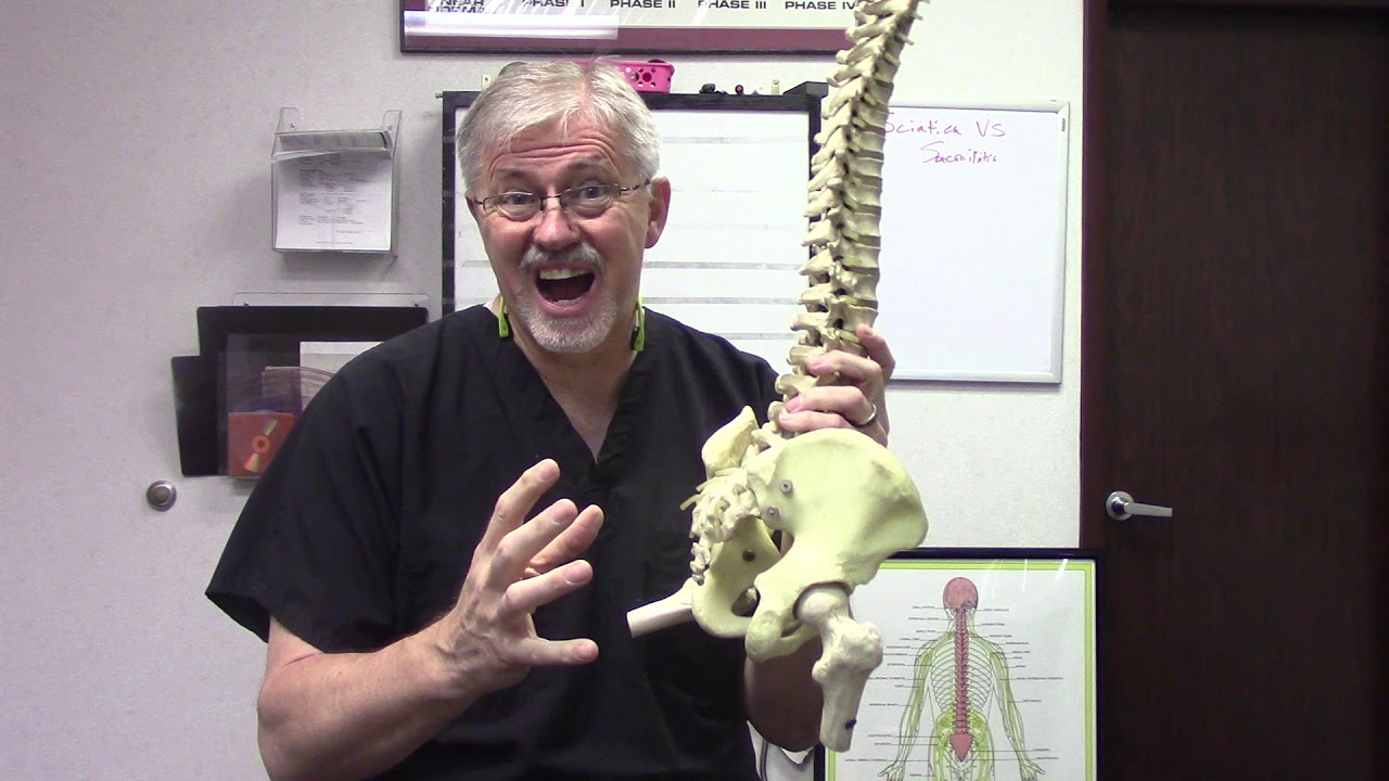 Sciatica Vs Sacroiliitis Youtube 0139
