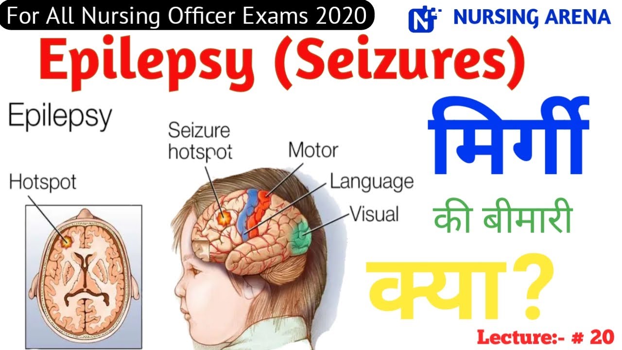 Epilepsy Seizure Types Of Seizures Free Online Nursing Classes epilepsy-seizure-types-of-seizures-free-online-nursing-classes