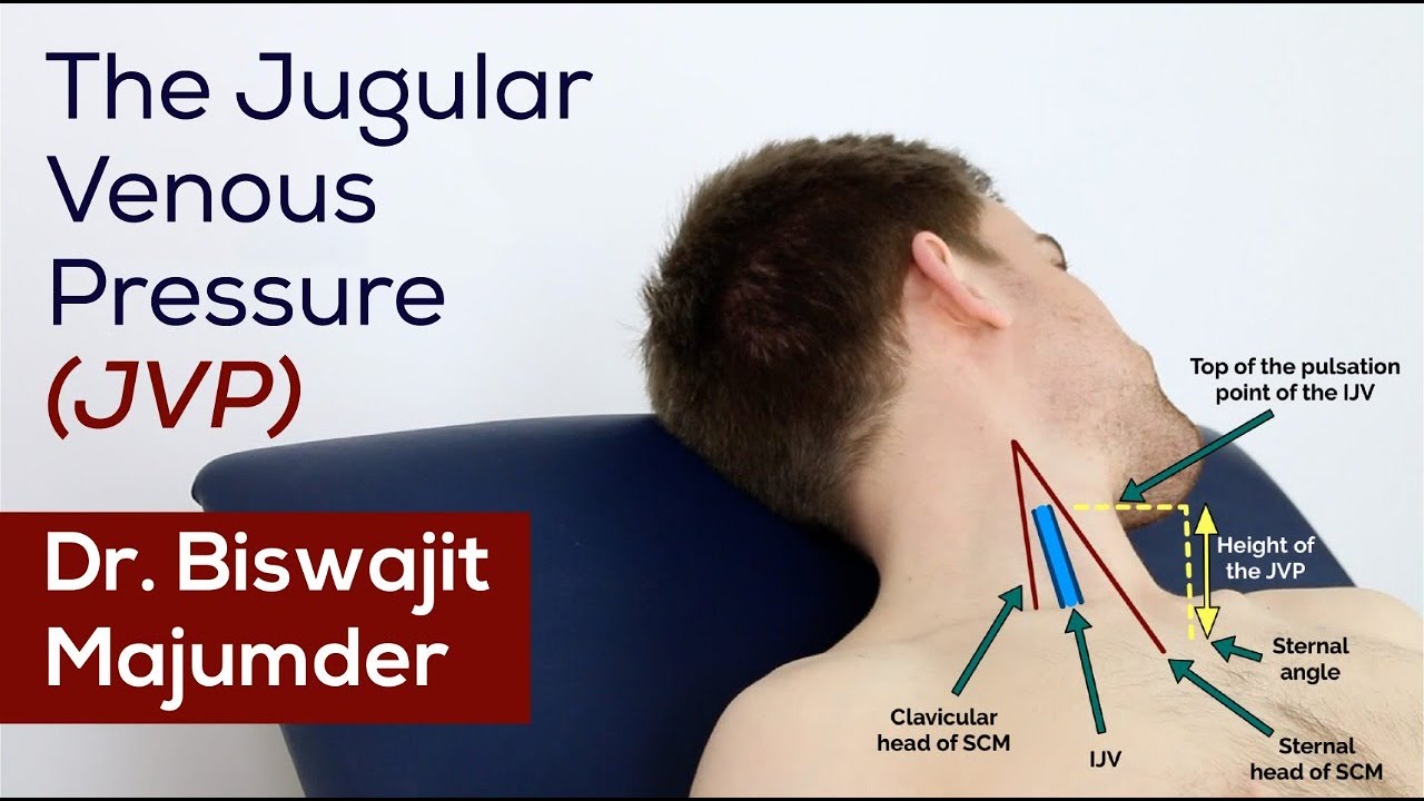 The Jugular Venous Pressure (JVP) | Dr. Biswajit Majumder - YouTube