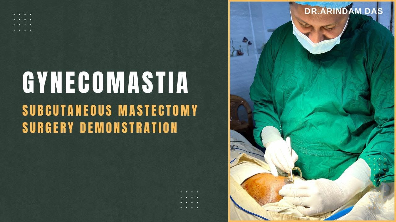 Gynecomastia (Surgical Principles of Subcutaneous Mastectomy) - YouTube