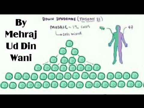 DOWN SYNDROME (Trisomy 21) | Full Info | For Class 12th(ZOOLOGY) | BY ...