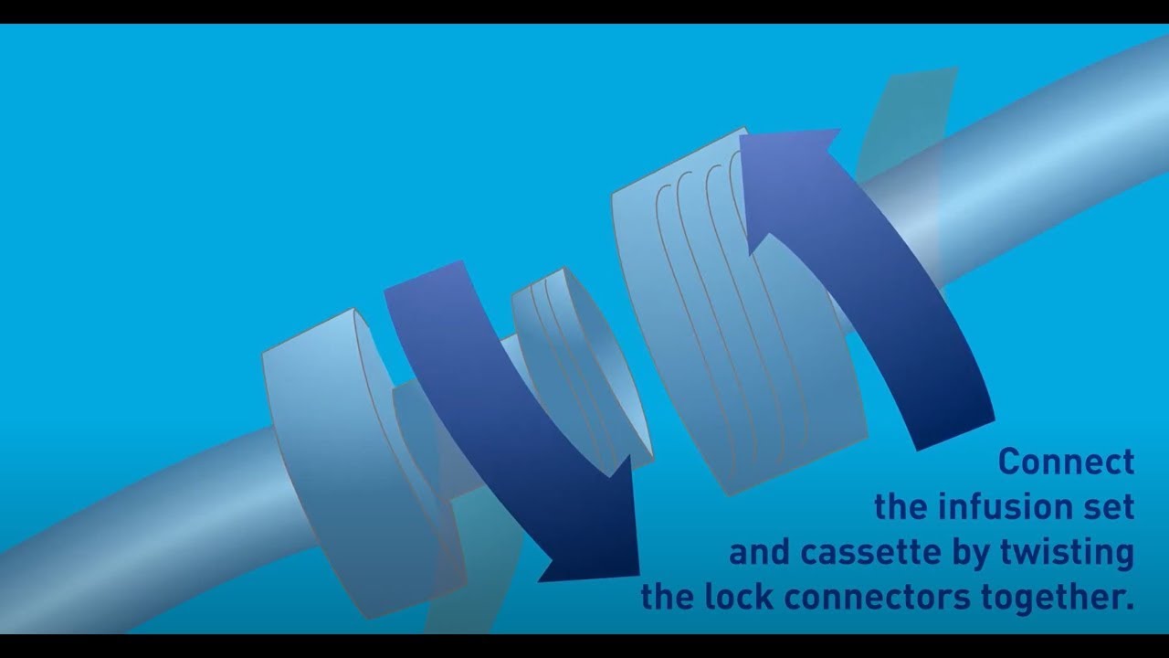 Remunity User Guide Video 3: Cassette Change - YouTube