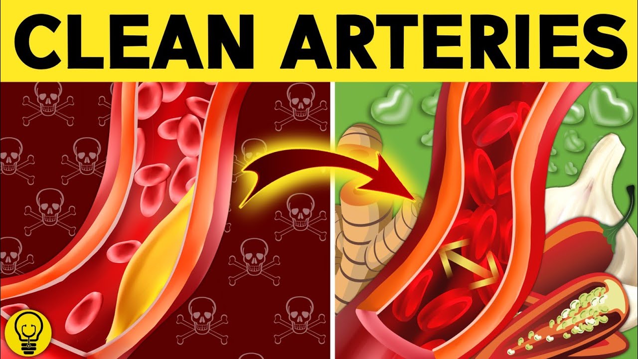 Top 7 Spices To Clean Your Arteries That Can Prevent A Heart Attack