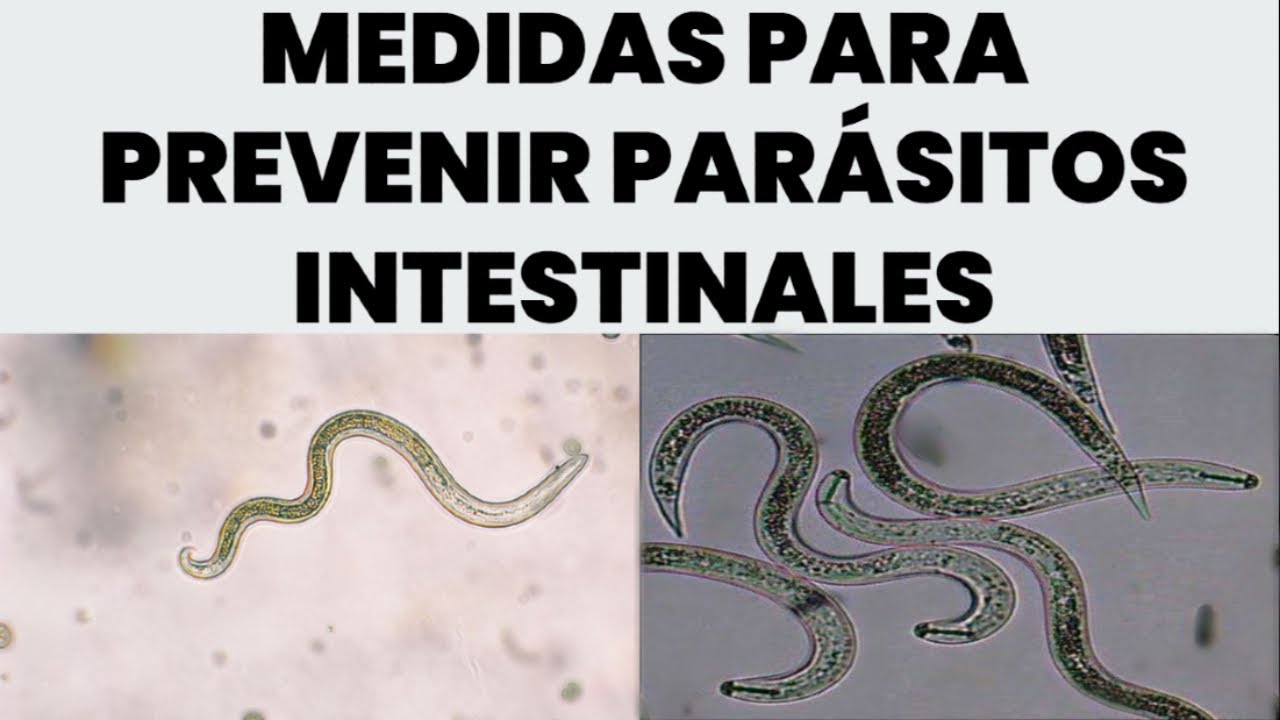 Guía de Prevención: Medidas Efectivas contra Parásitos Intestinales ...