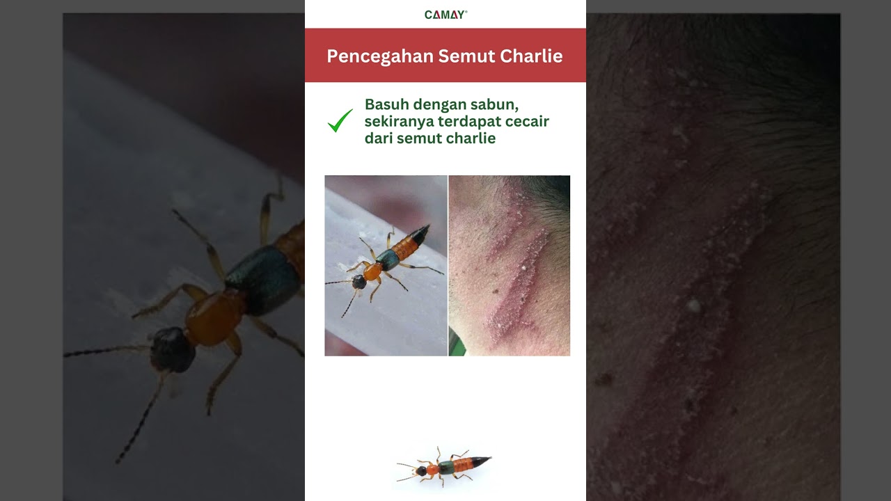 5 CARA CEGAH DARI SERANGAN SEMUT CHARLIE (TOMCAT - ROVE BEETLE) - YouTube