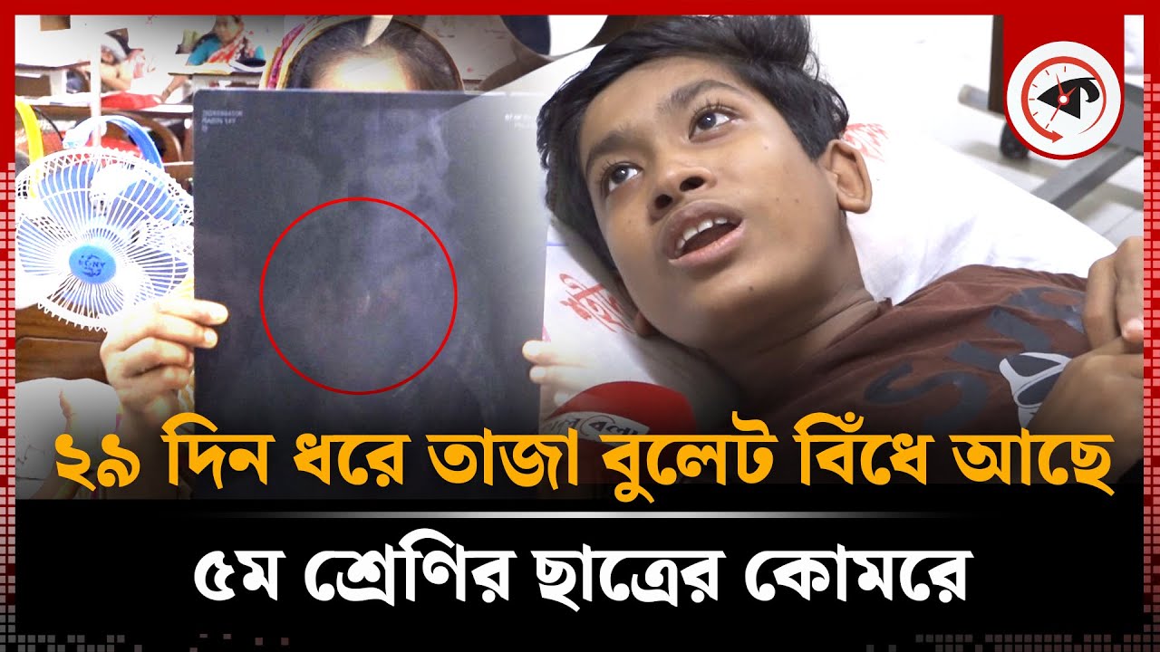 ২৯ দিন ধরে তাজা বুলেট বিঁধে আছে ৫ম শ্রেণির ছাত্রের কোমরে | 5 Years ...
