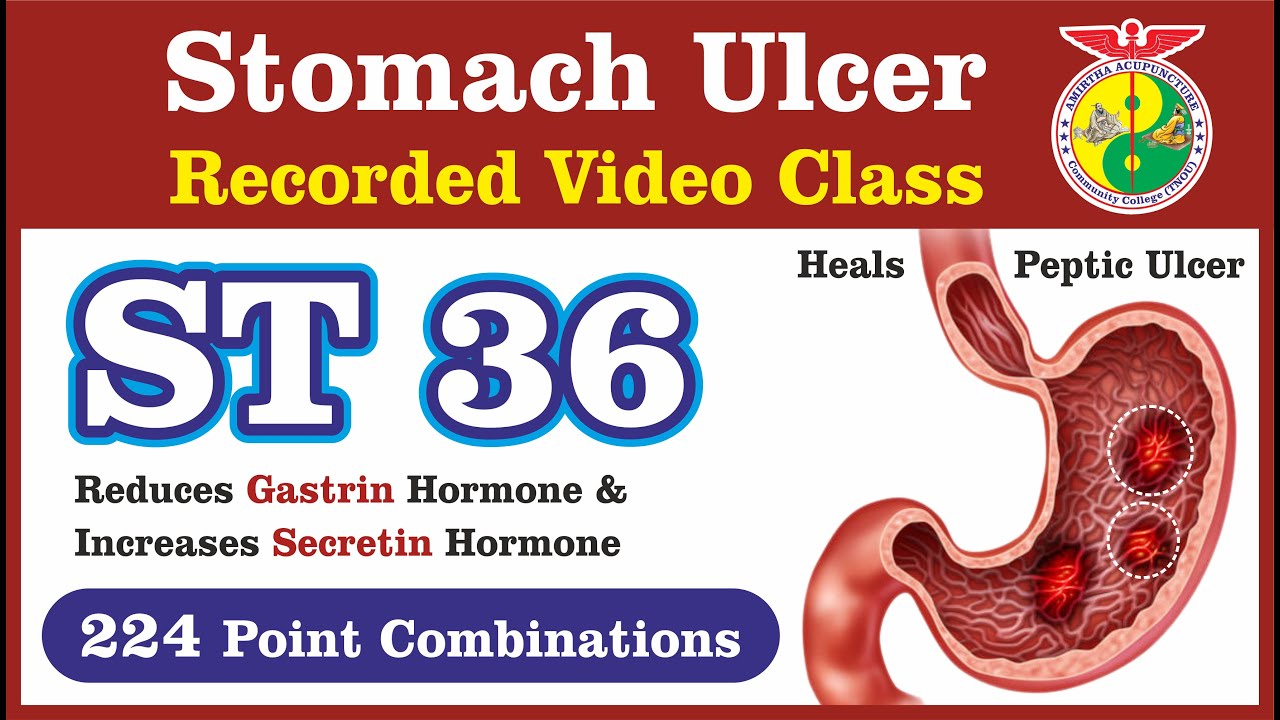 ☯️ ST-36 புள்ளி & அல்சர் (வயிற்றுப்புண்) | Stomach Ulcer #acupuncture # ...