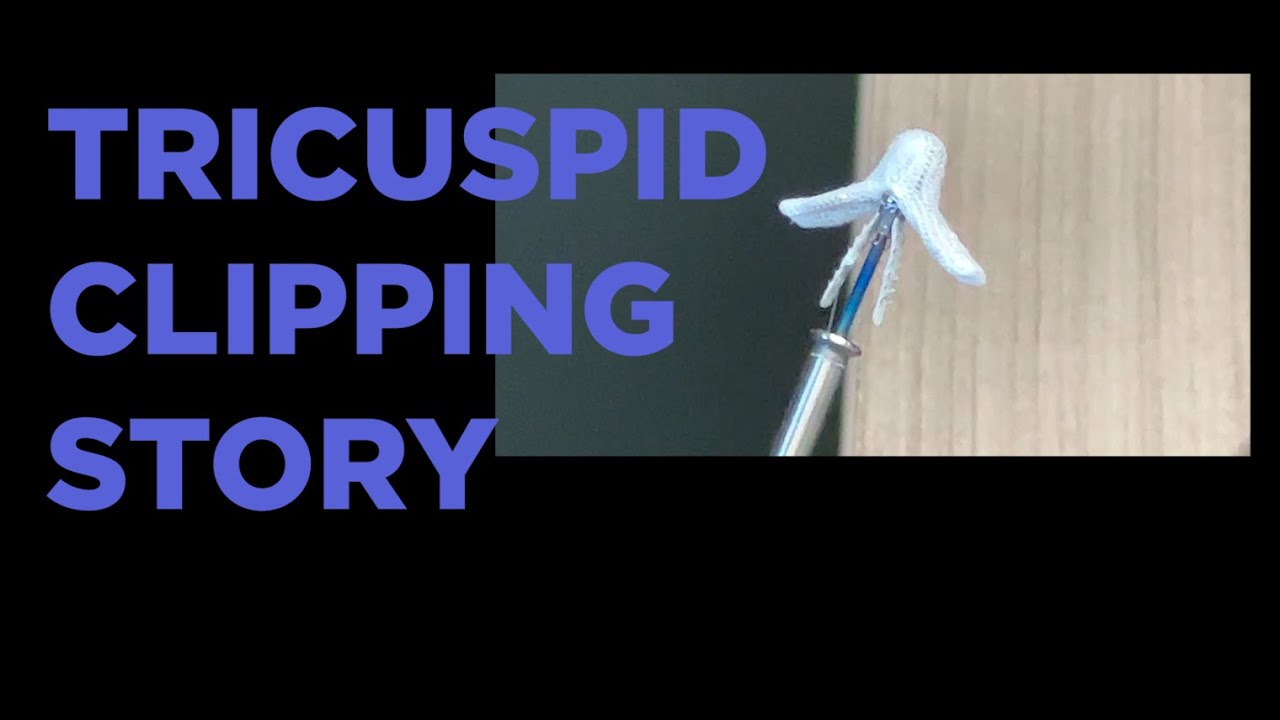 TRICUSPID CLIPPING pkg - YouTube