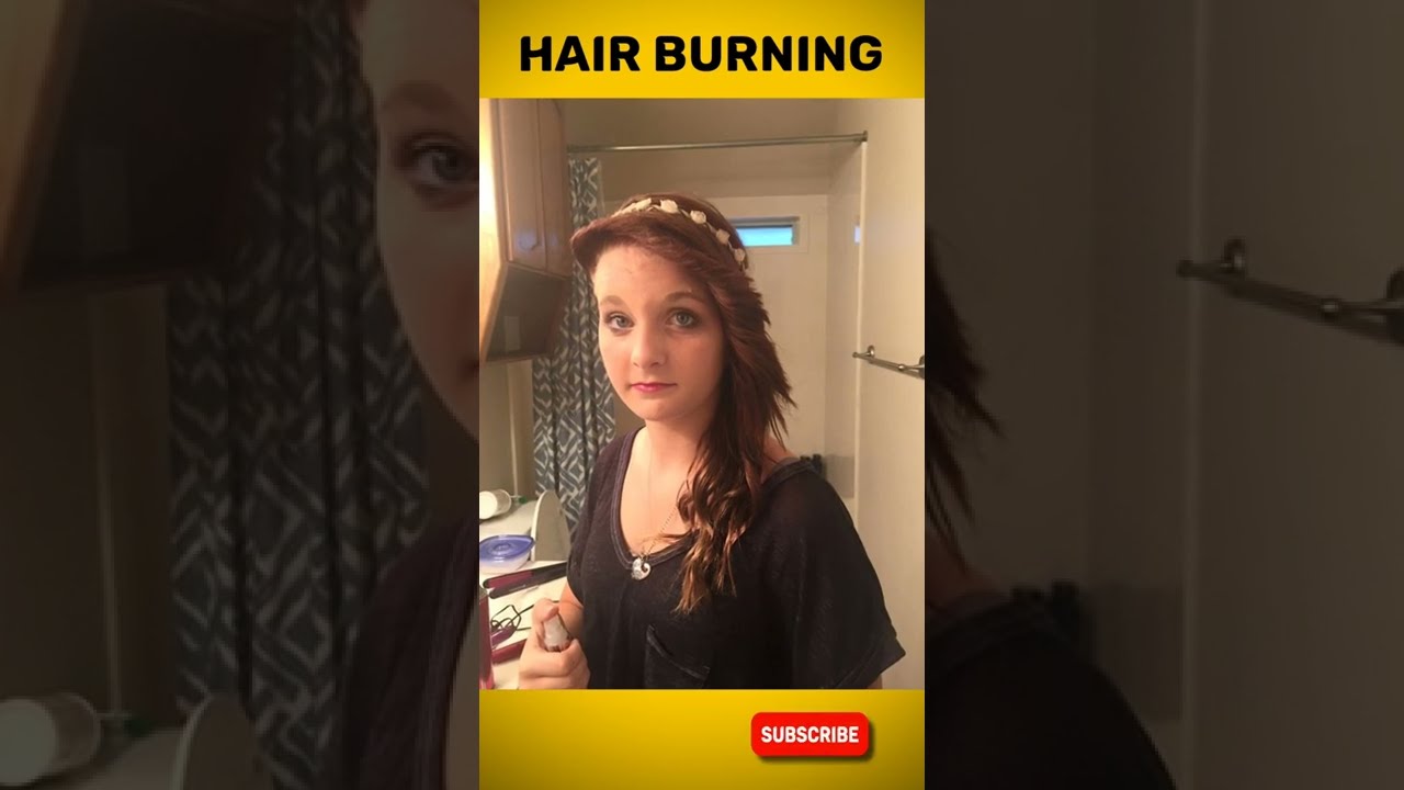 Girl Lost Her Hair Because Of A Boy | Hannah Combs #shorts - YouTube