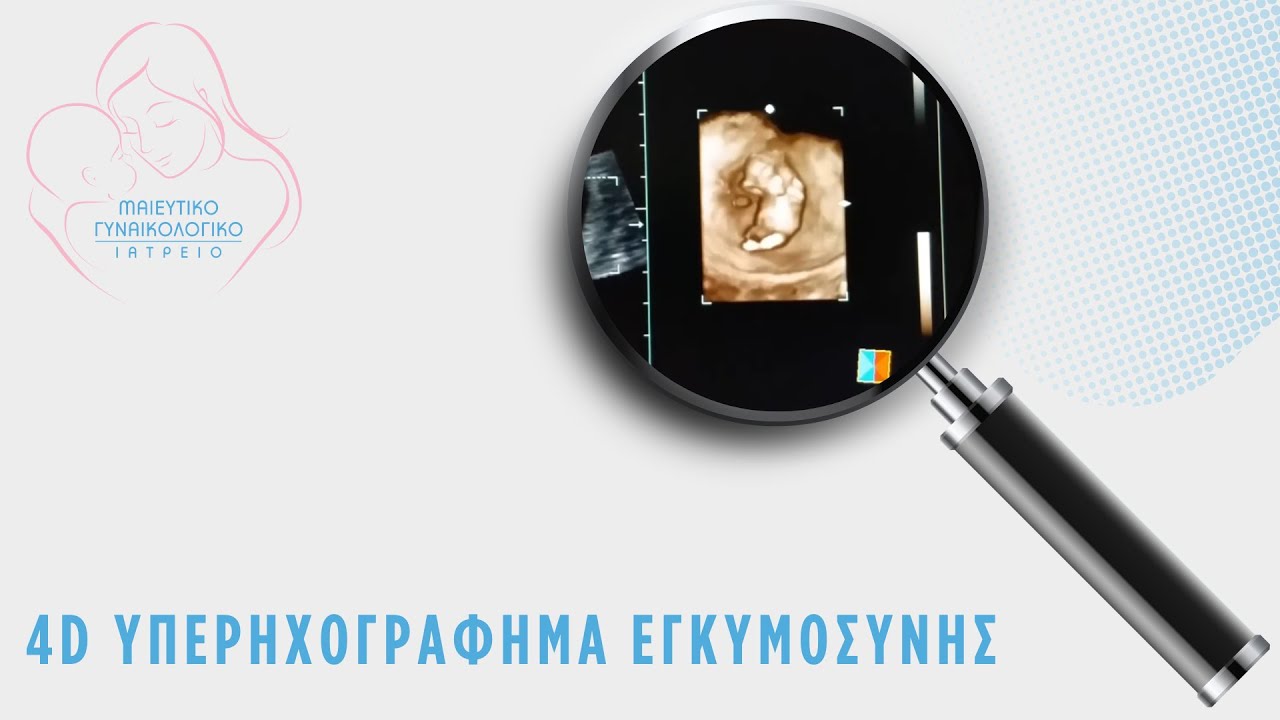 4D υπερηχογράφημα εγκυμοσύνης (11 εβδομάδων) - YouTube