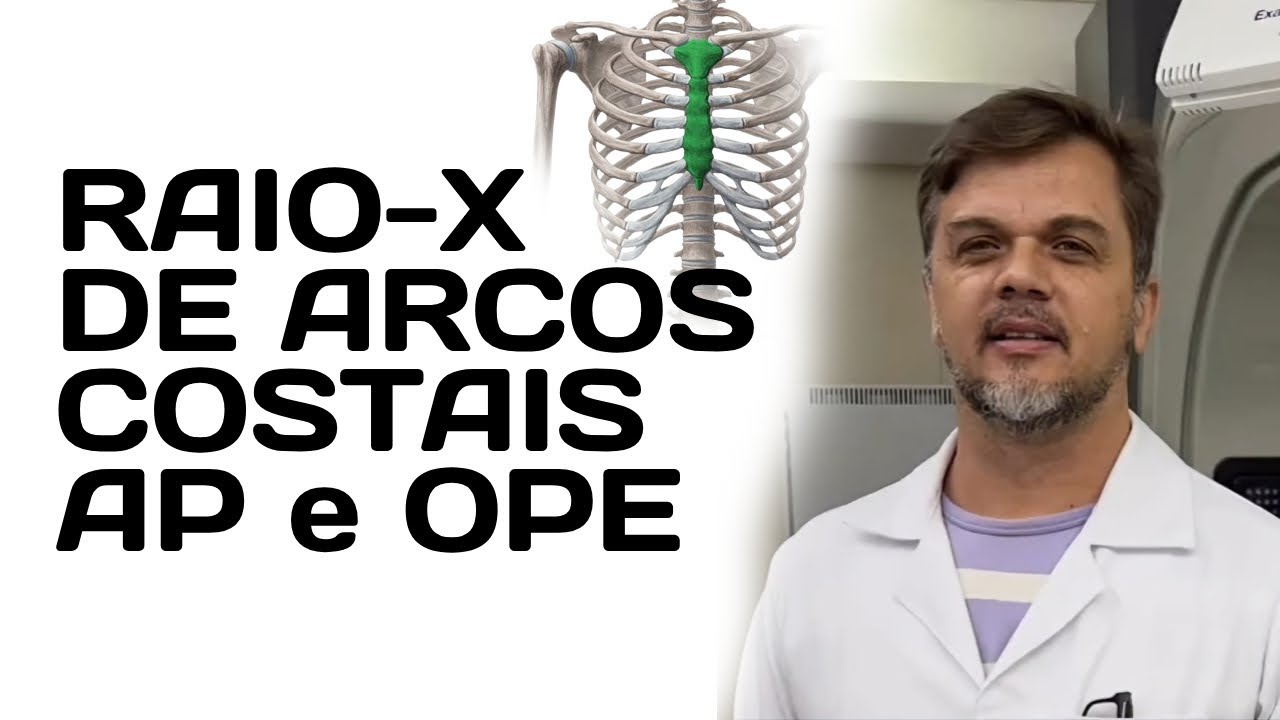 Rx Arcos Costais AP e OPE - Posicionamento - YouTube