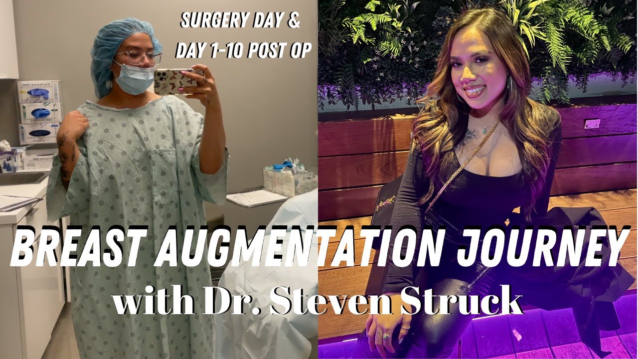 I GOT A BOOB JOB! | BREAST AUGMENTATION + CHIN LIPO | SURGERY DAY ...
