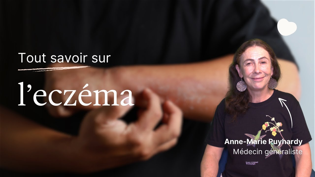 Eczéma : causes, traitements et prévention - YouTube