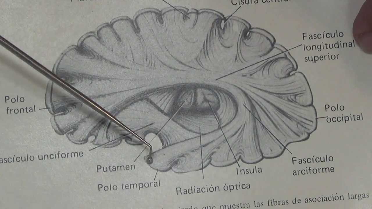 IV CURSO DE DISECCIÓN DE ENCÉFALO; DISECCIÓN DE FASCÍCULO UNCIFORME ...