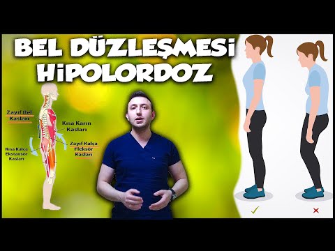 BEL DÜZLEŞMESİ EGZERSİZLERİ | HİPOLORDOZ Tedavisi ve Bel Çukuru Geri Kazanma Rutini (Kesin Çözüm)