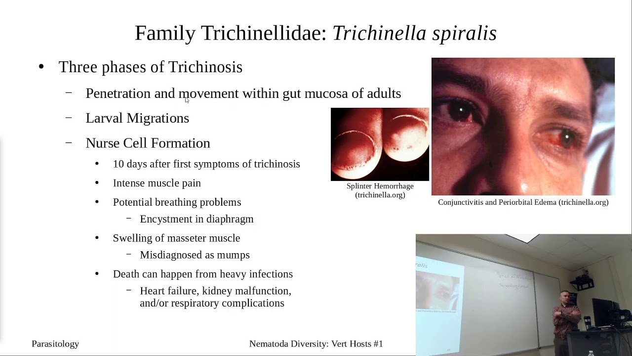 Trichinella spiralis - YouTube