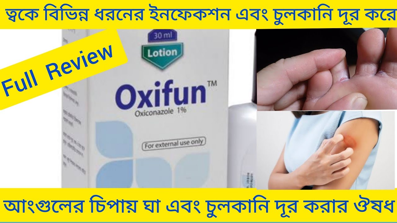 Oxifun location/ত্বক আঙ্গুল এর চিপায় ঘা চুলকানি দূর করার ঔষধ/ Oxifun ...