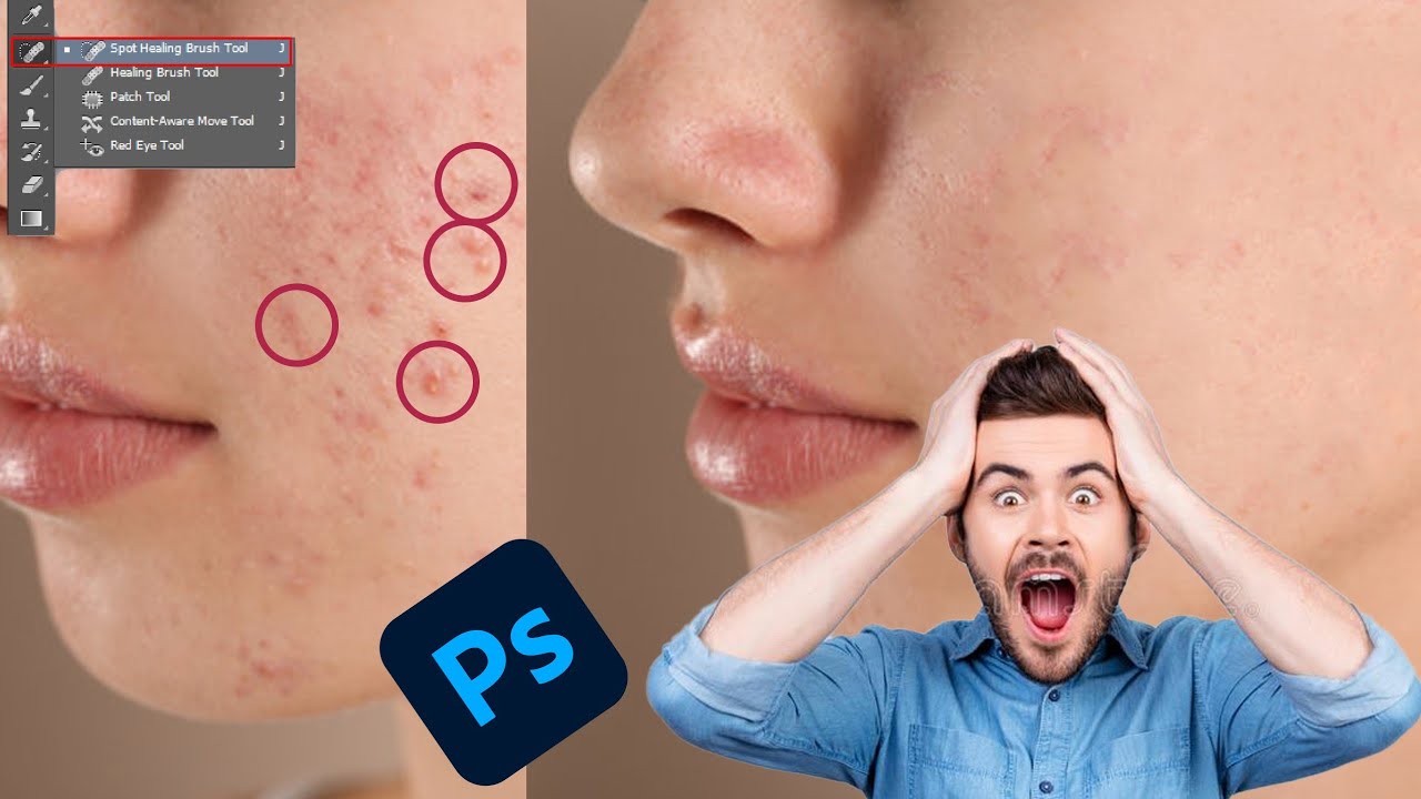 healing brush tool | spot healing brush tool - YouTube
